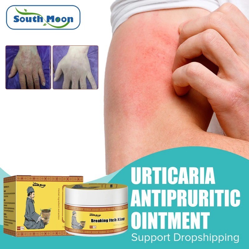 Eczematoid Eczema Ointment Inhibit Dermatitis Urticaria Hand Tinea ...