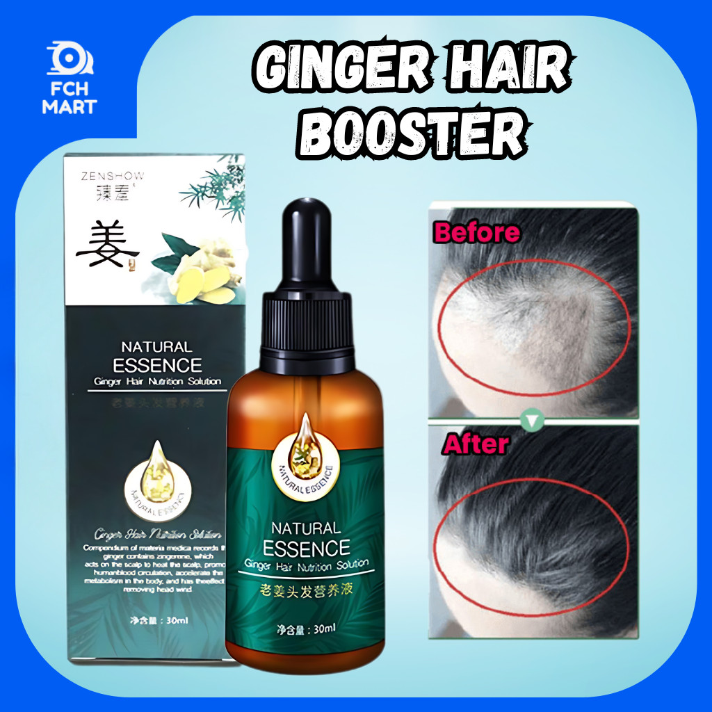 Ginger Hair Growth Tonic Ginger King Hair Growth Serum Tumbuh Rambut ...