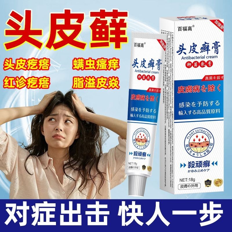 Scalp tinea capitis head special psoriasis scalp seborrheic scalp Rise ...