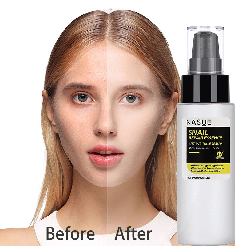 Nasue OEM Snail Collagen Essence Fade Fine Lines Nasolabial Lines Firm ...