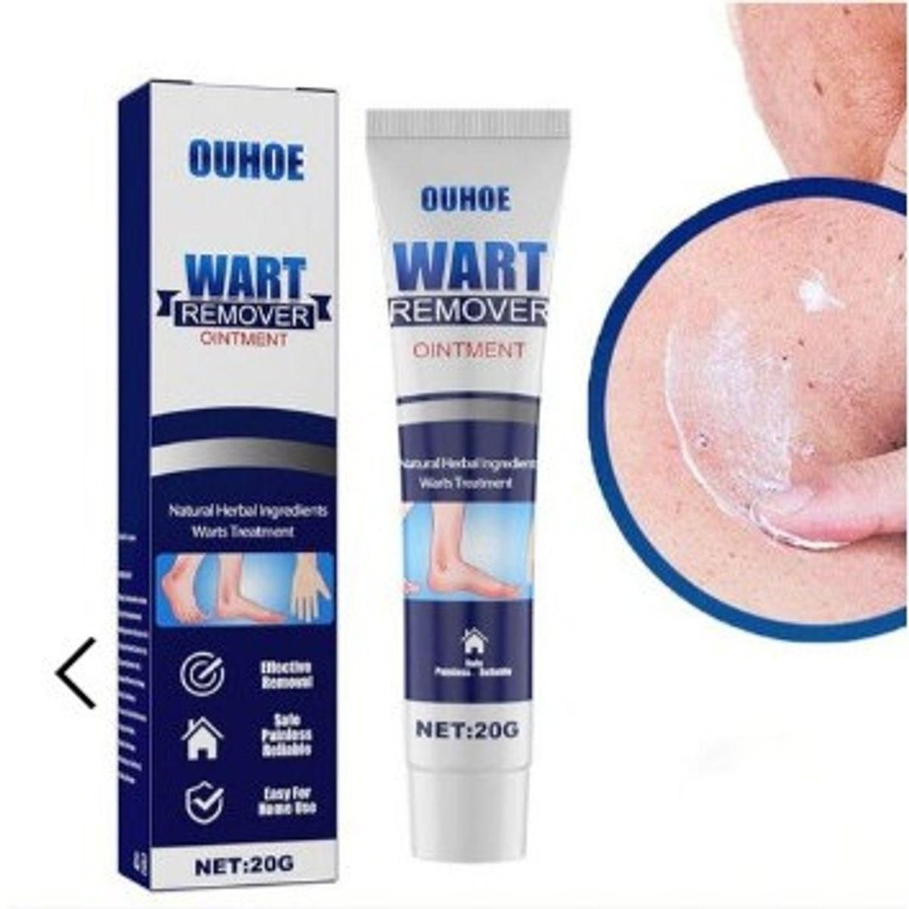 Ouhoe WART REMOVER Genuine Skin Acne and Mole Removal Cream Imported ...