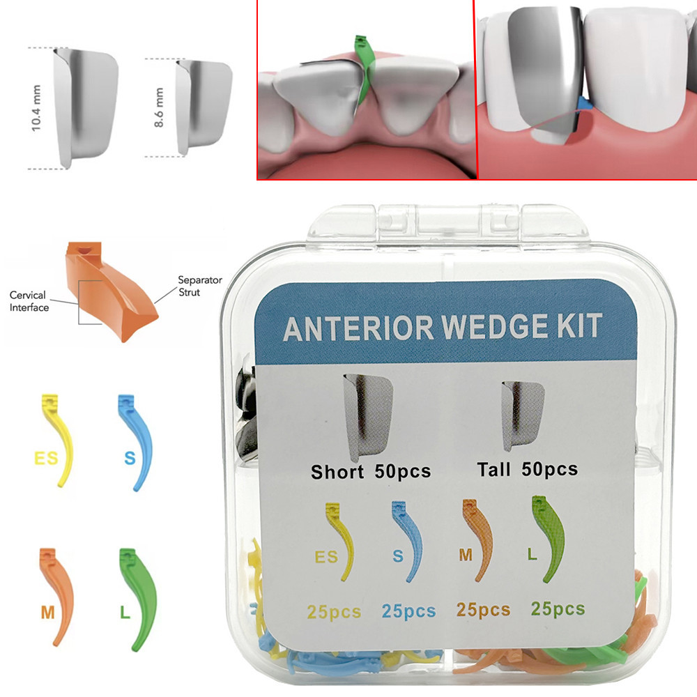 200Pcs/set Dental Anterior Matrix System Wedge Matrix Bands Interdental ...