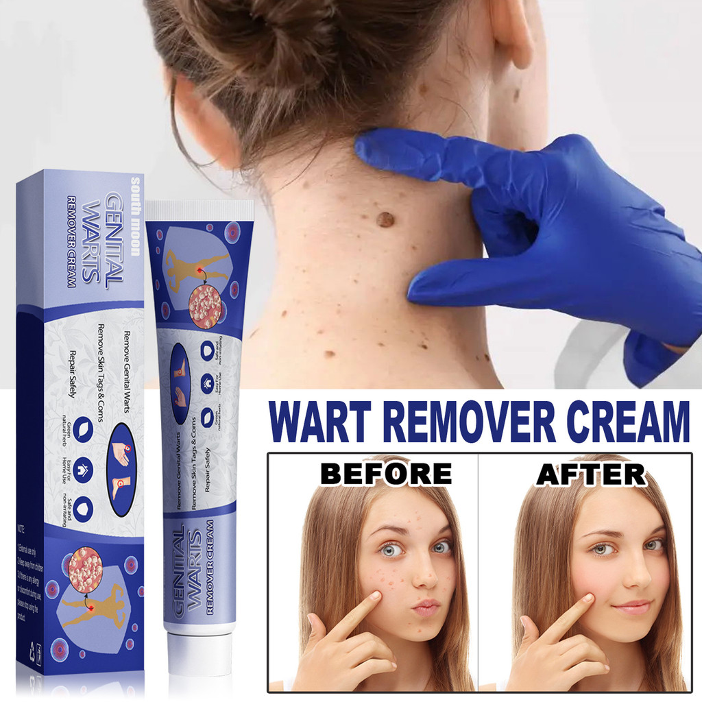 EELHOE removal of corns warts ointment Care Ke Wart Repair Keyu Body ...