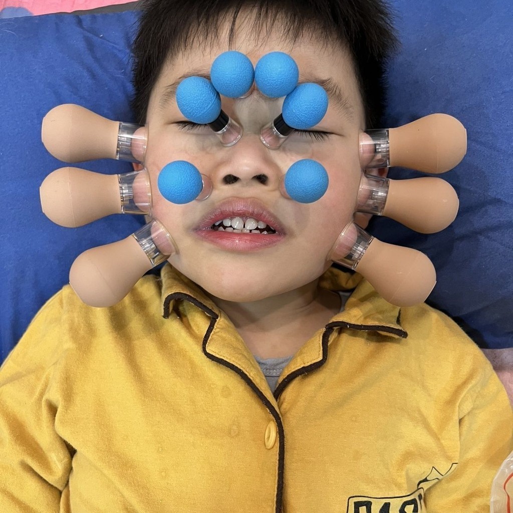 [Ready Stock] Children's Cupping Myopia Conditioning Gastrointestinal ...