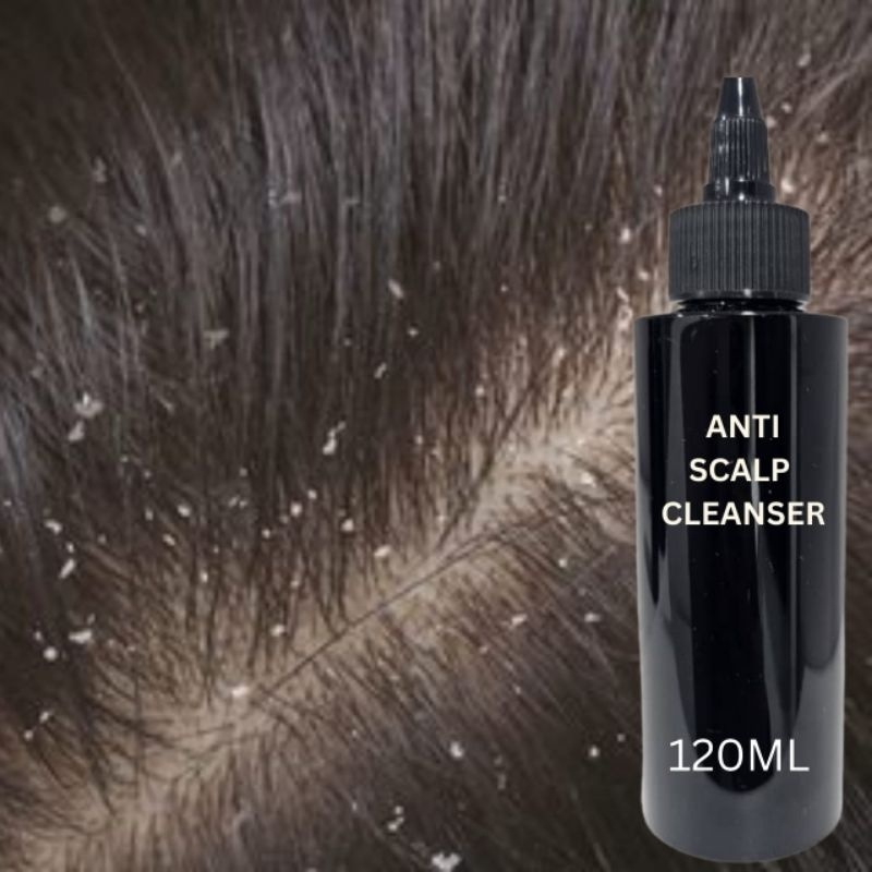 OEM Wholesale Professional Anti Hair Scalp/Anti Scalp Cleanser/Shampoo ...