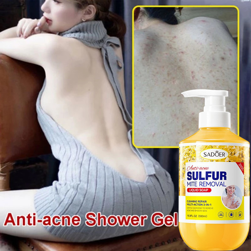 acne body wash whitening body wash sabun badan jerawat 500ml acne treatment Relieves itching ...