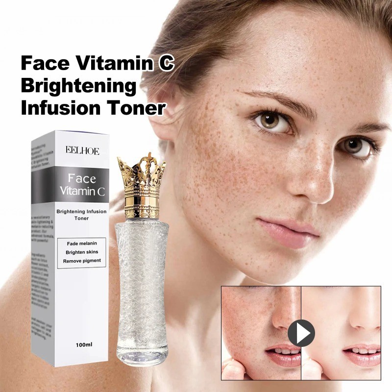 Vitamin C Serum Anti Dark Spot Brighten Freckle Remove Melasma Pigment Corrector Fade Melanin ...
