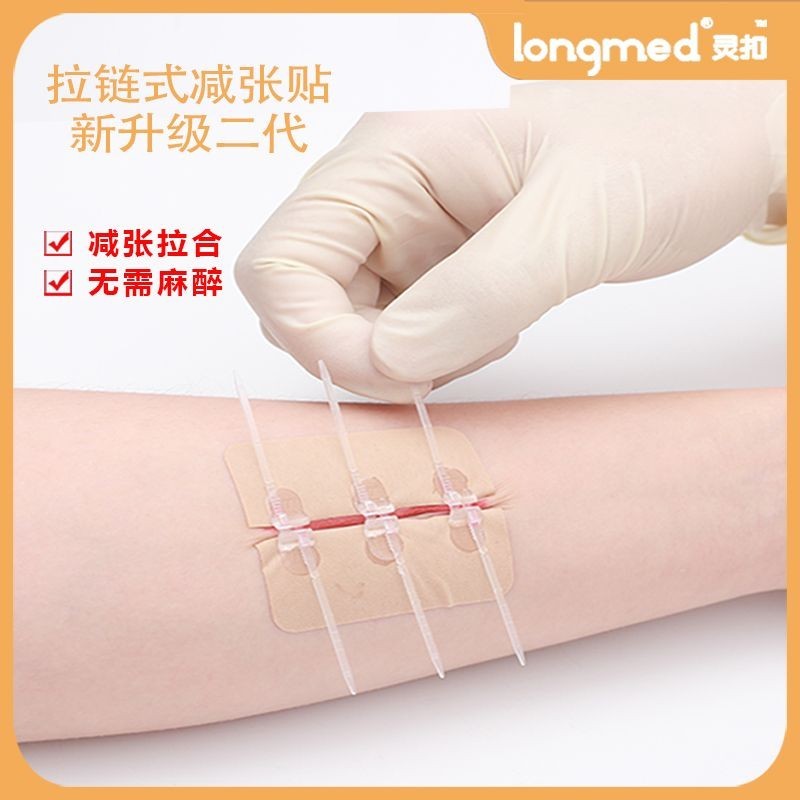 Tension reducer skin wound medical scar healing surgery caes reducer ...