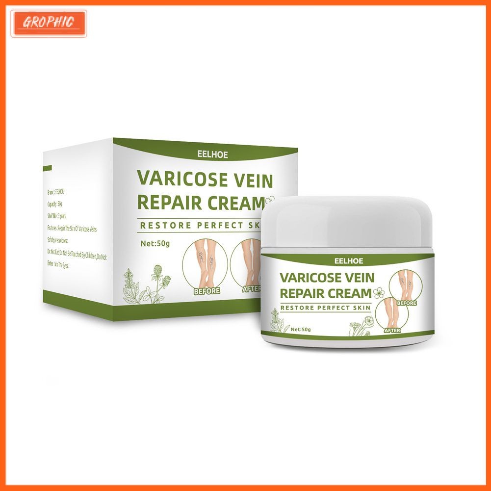 Vasculitis Relief Cream Rapid Results Varicose Vein Cream Effective Leg ...