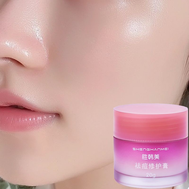 Quick Repair Acne Removal Cream Student Men Women Remove Acne Marks ...