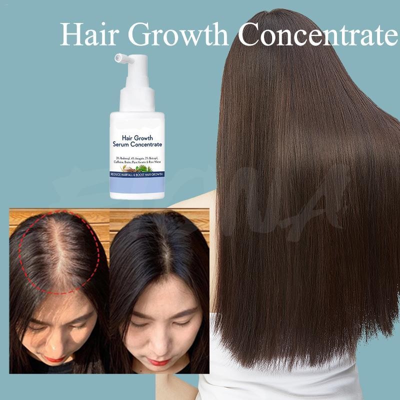 Hair Growth Concentrate 30ml Effective Hair Regrowth Essence Mild ...
