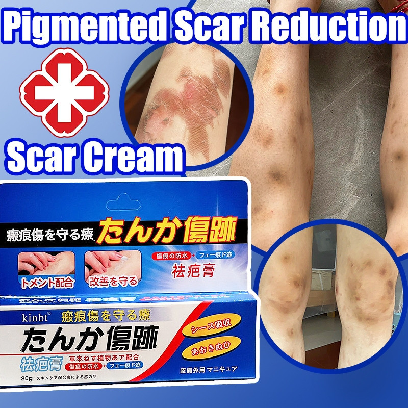 Scar Removal Cream 20G Remove melanin scars cream Mosquito bite scar ...