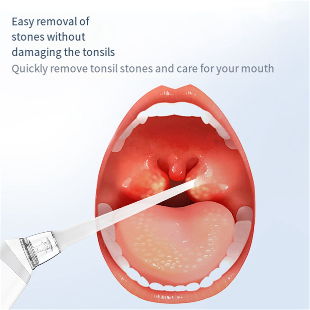 Electronic Tonsil Stone Remover Vacuum, Tonsil Stone Removal Kit, Instant Suction Tonsil Stone ...