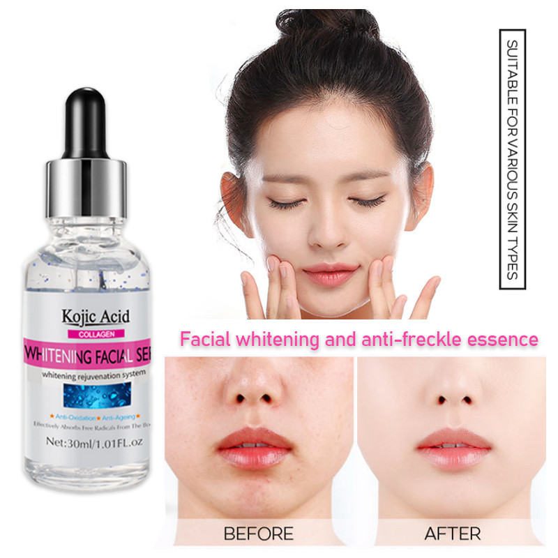 whitening serum brighten fade acne dark spot pigmentation melanin moisturizing Whitening Face ...