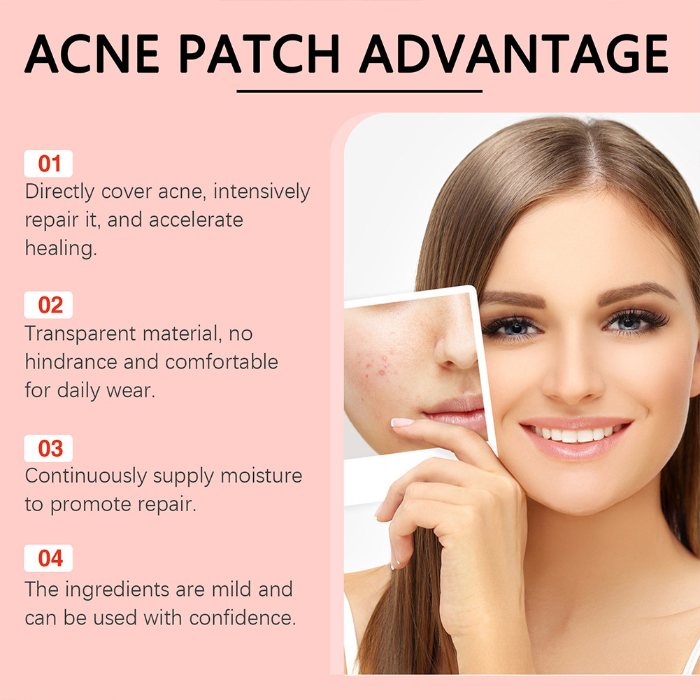 lotsofgoods Acne Pimple Patch Hydrocolloid Ance Patches Waterproof Acne ...