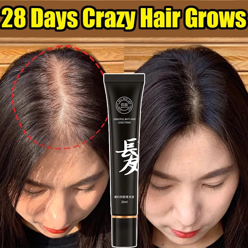 Losyen rambut urut bola khas losyen rambut anti-keguguran rambut ...