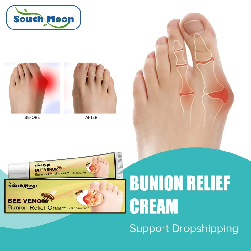 Toe Swelling Relief Cream Gout Treatment Hallux Valgus Corrector Finger ...
