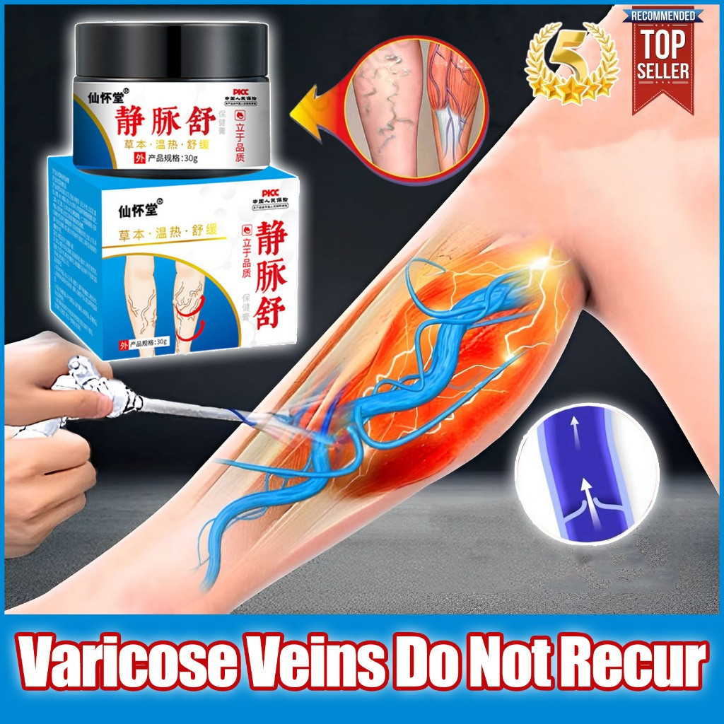 Varicose Veins Cream 30g Spider Vein Pain Relief Ointment Leg Vein Pain ...