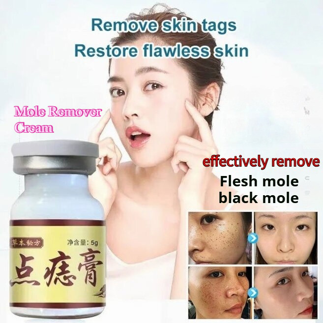 5g Mole dropping Cream No Mark Remove Eugene Moles Flat Meat Thorn ...