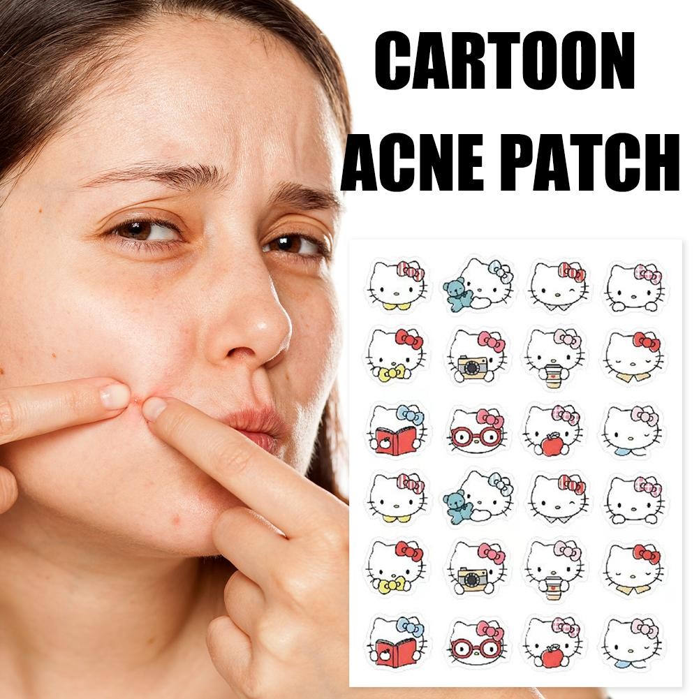 120pcs Cute Cartoon Acne Patch Mild Soothing Acne Patch Hydrocolloid ...