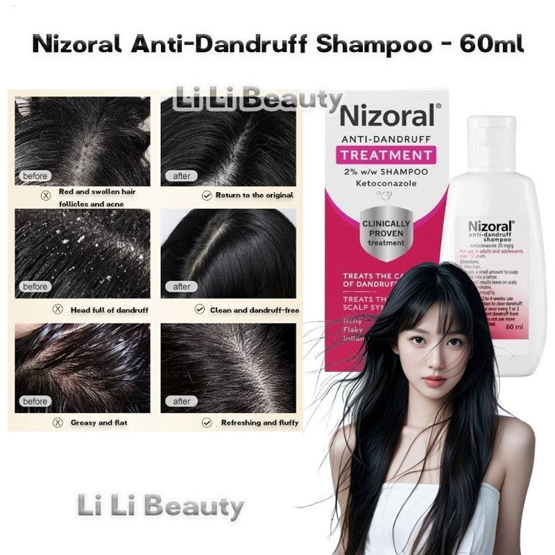 Nizoral Anti-Dandruff Shampoo - 60ml Scalp Cleansing Shampoo Build up ...
