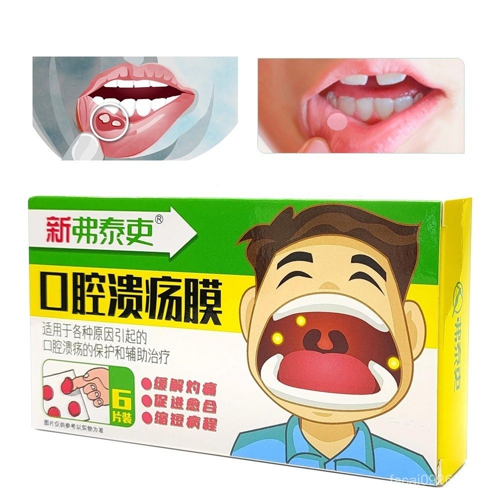 Oral Ulcer Mask (Xinfutaili) Oral Ulcer Patch 6Pcs/Box Relieve Serious ...
