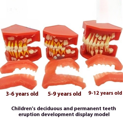 Children Teeth Model Replacement Tooth Model Deciduous Permanent Teeth ...