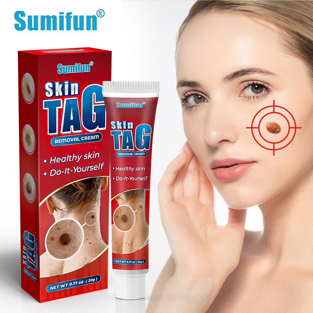 Sumifun 20g Corn Skin Tag Warts Remover Ointment Wart Cream for Plantar ...