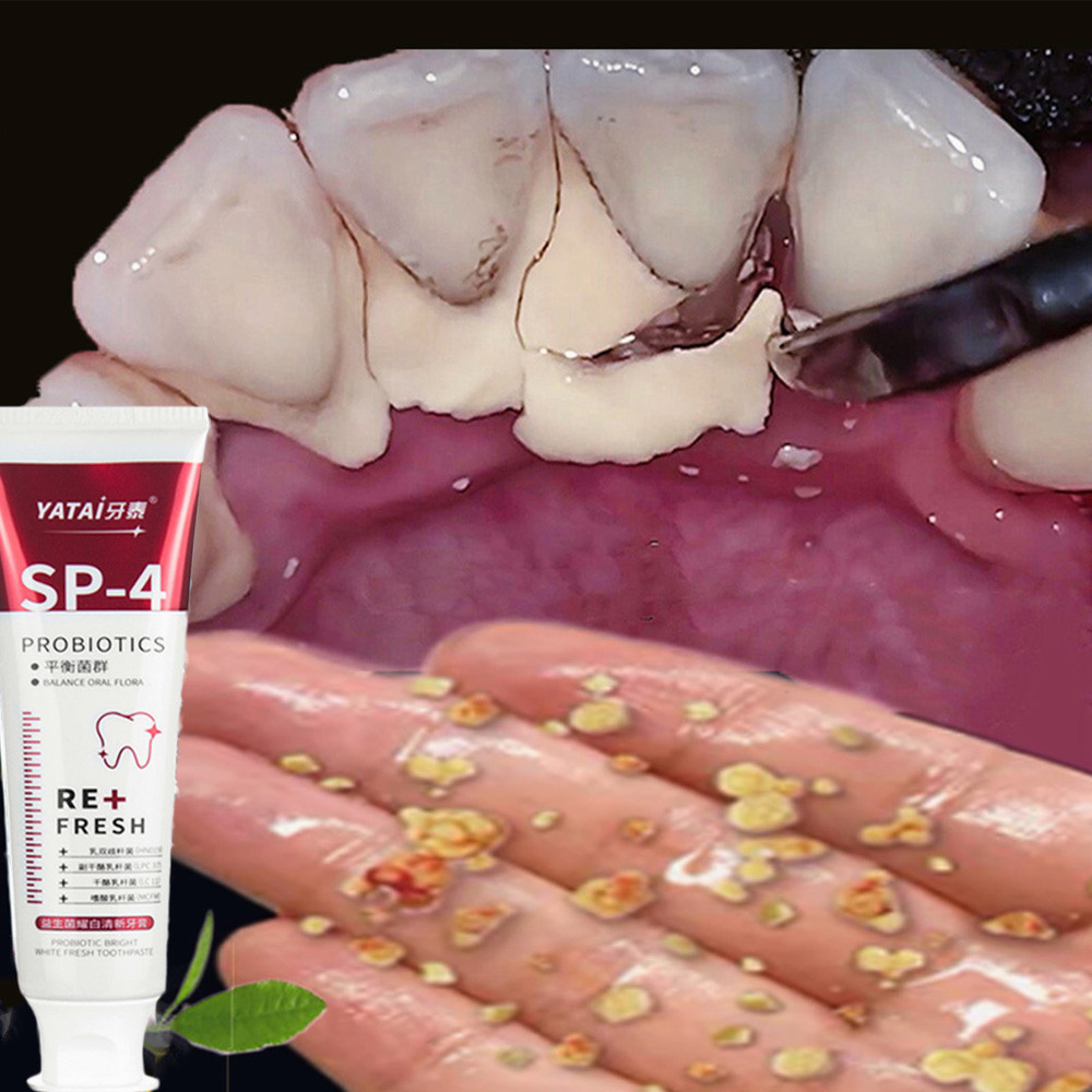 teeth sp-4 whitening original probiotic toothpaste Probiotics oral shark whitening toothpaste ...