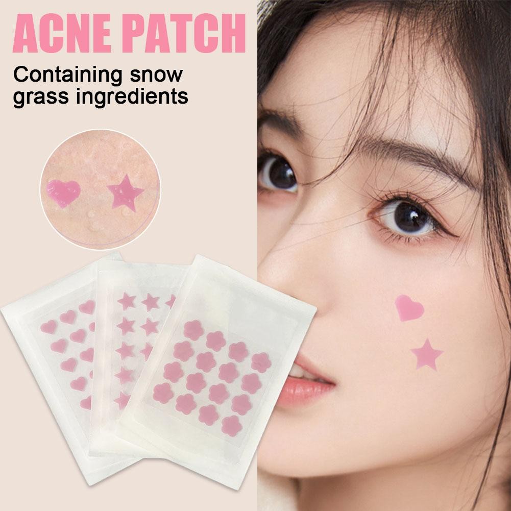 20pcs/set Hydrocolloid Acne Pimple Patch Colorful Butterfly Spot Care ...