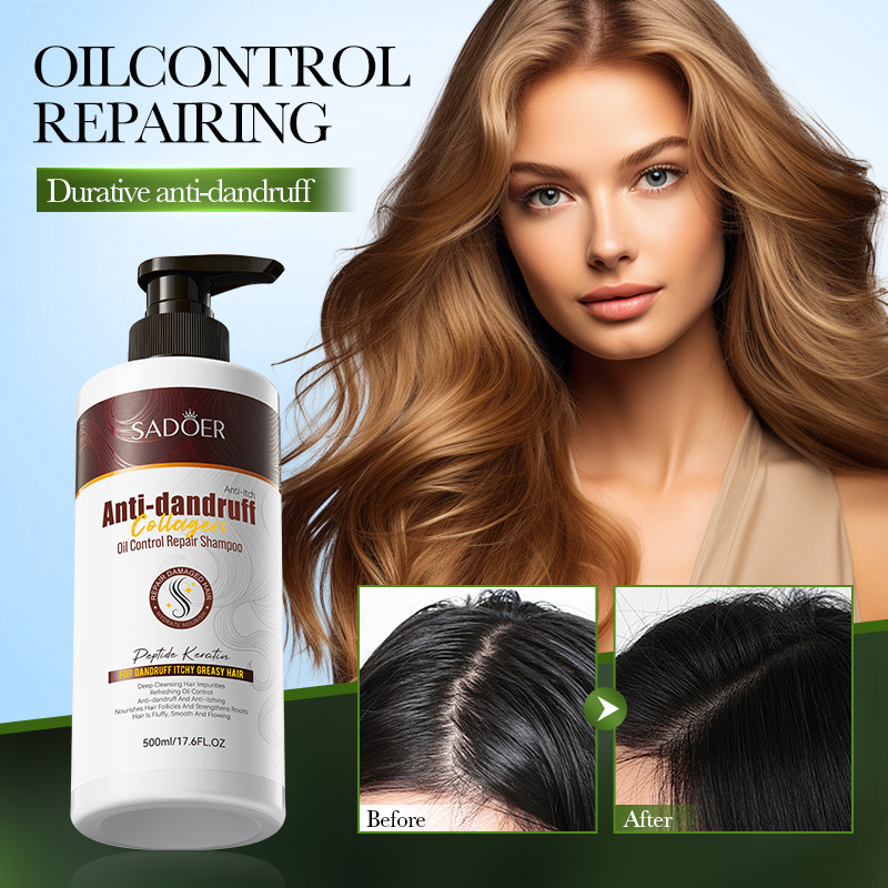 ROREC SADOER Peptide Keratin Collagen Anti-Dandruff Anti-Itch Oil Control Repair Damage Hair ...