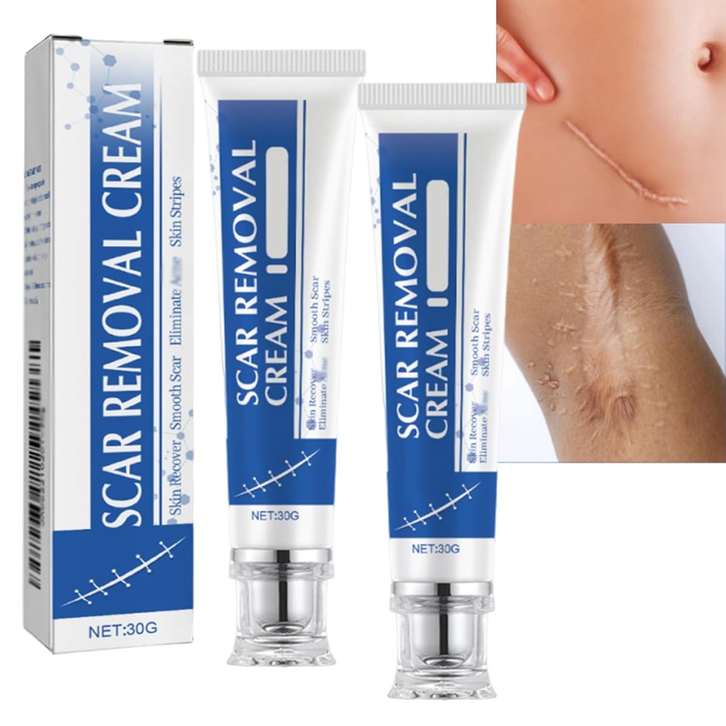 Krim Penghilang Parut,1oz Gel Penghilang Parut,Krim Pembaikan Parut ...