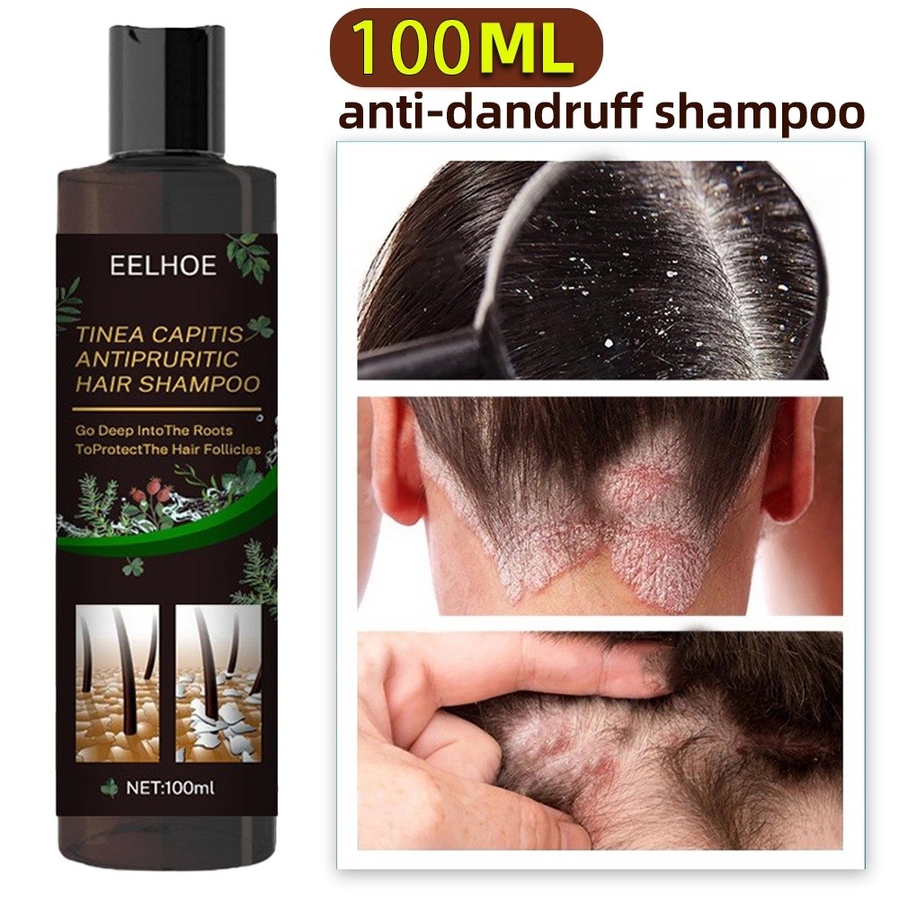 【EELHOE】100ml Tinea Capitis Anti-Itch Shampoo Tinea Capitis Scalp Anti ...