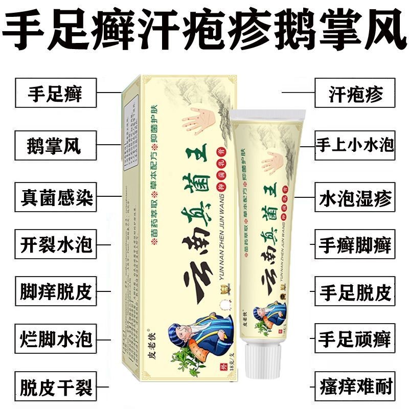 Hand Hand Hand Foot Hand Foot Fungus Infection Special Effects Blister ...