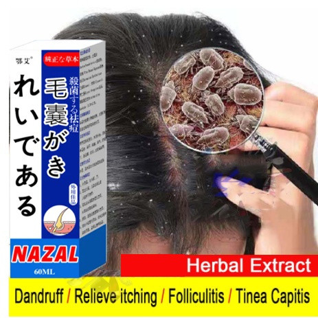penjagaan kulit Kulit Kepala Folliculitis Sembur Rambut Gugur ...