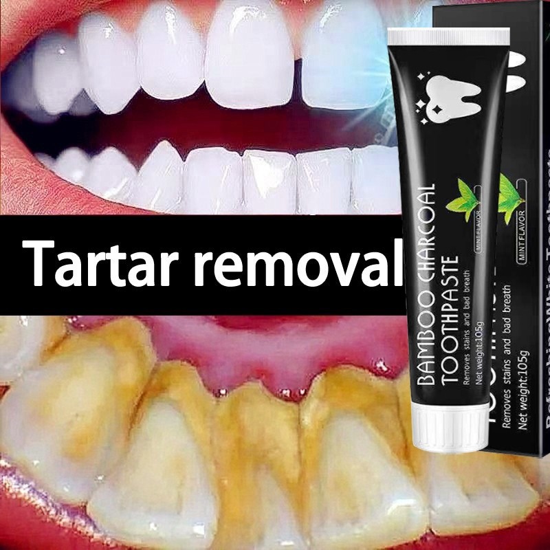 Charcoal Whitening Toothpaste Whitens Yellow Teeth and Cleans Tartar ...