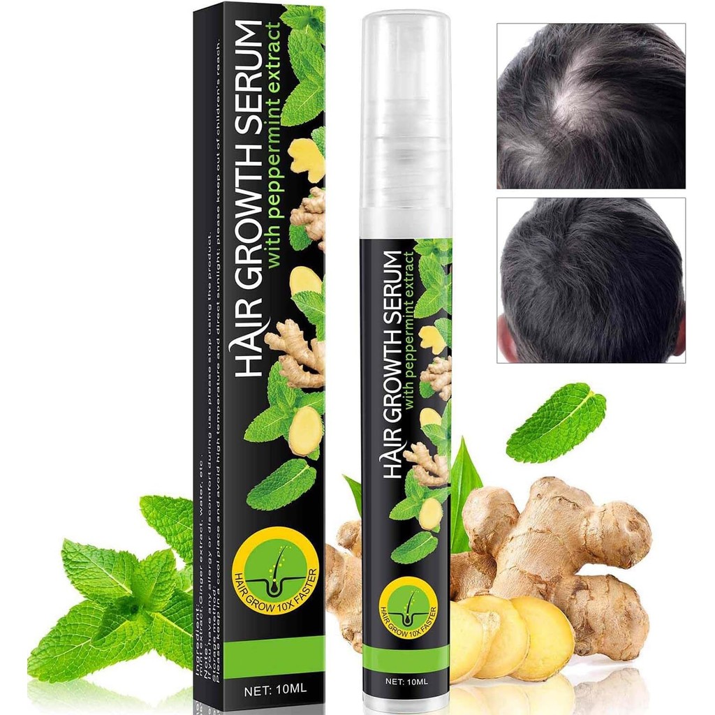 Peppermint & Ginger Hair Serum 10ml – Scalp Nourishment & Strand ...