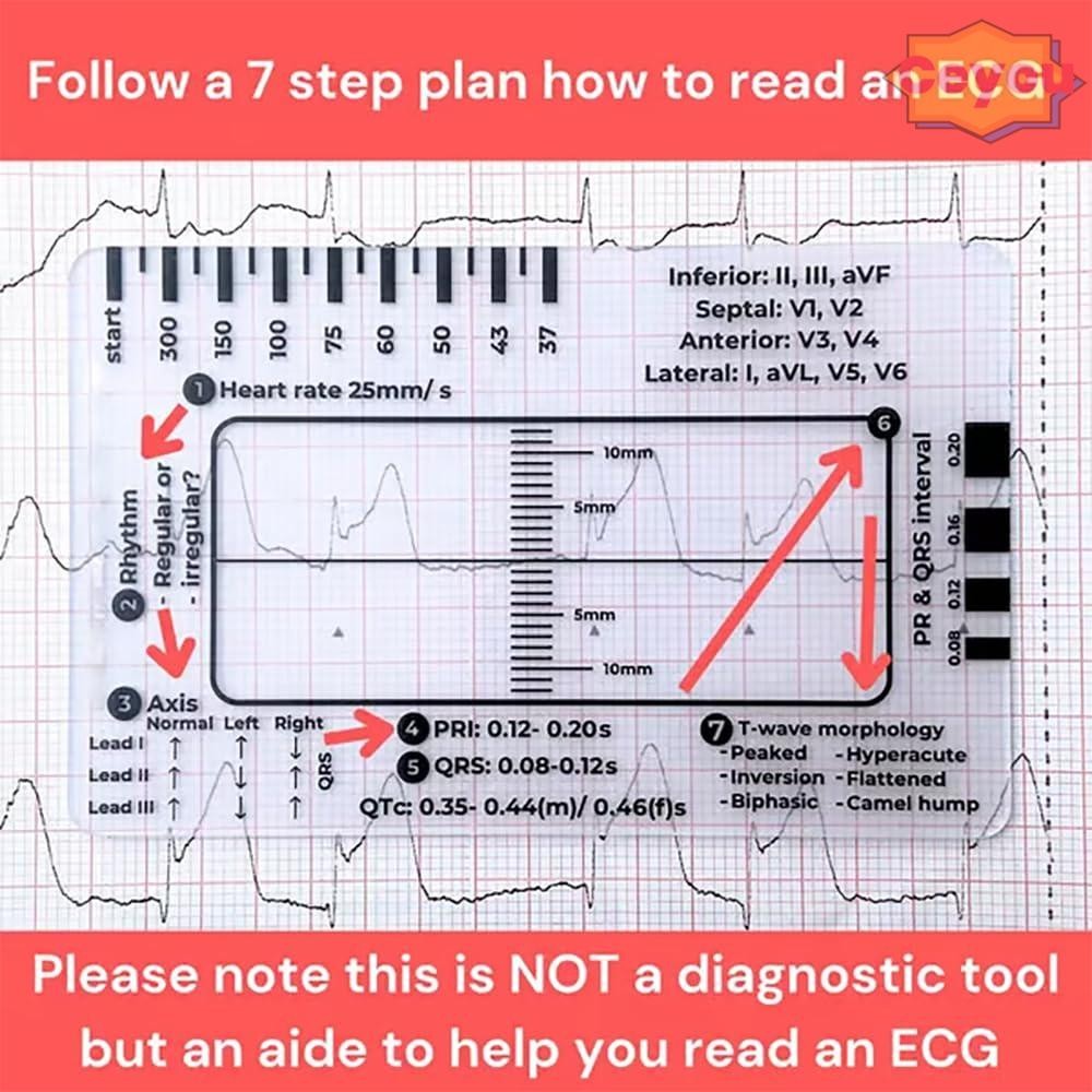 CEYOU EKG Calipers, ECG/EKG Plastic ECG 7 Step Ruler, Portable ...