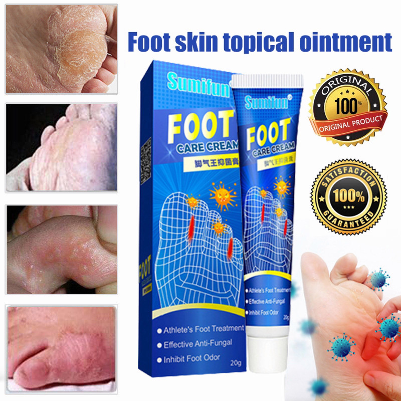 ubat kulat kaki ubat kaki Kaki mengelupas Kulat air Kaki gatal berbau ...