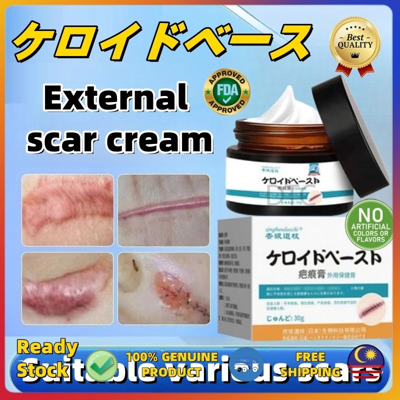 Japan Scar Removal Cream Mosquito Bite Scar Remove Black Scars Xingzaka ...