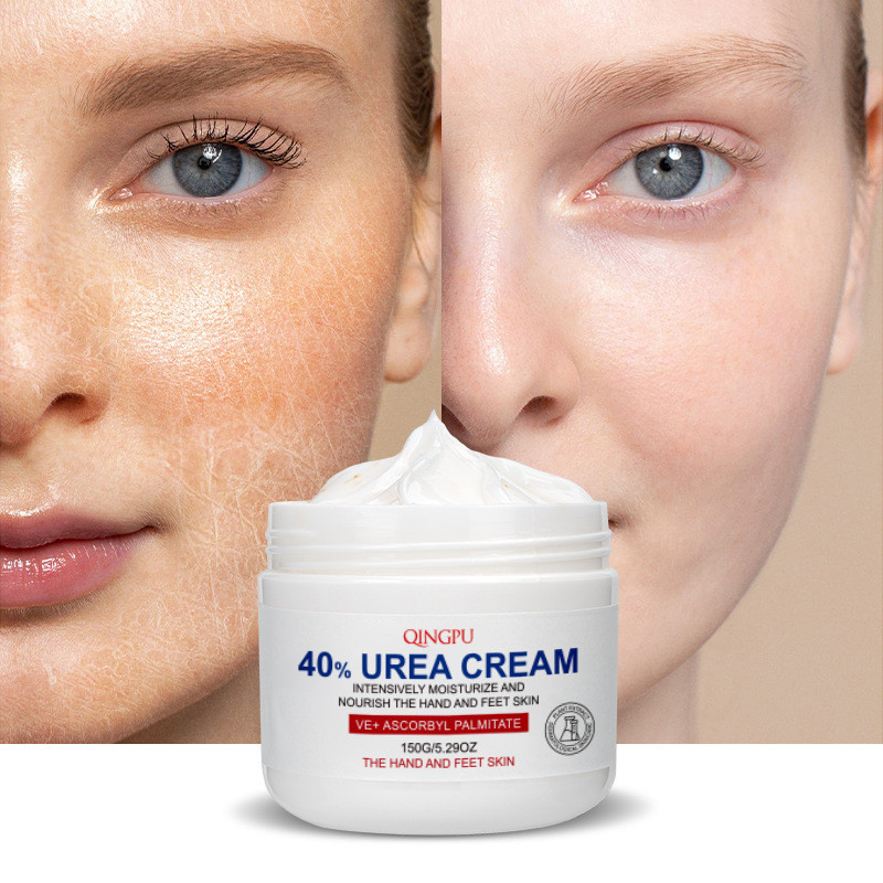 QINGPPU 40% Urea Cream Vitamin E Moisturizer Emollient Body Lotion Facials Body Care Anti ...
