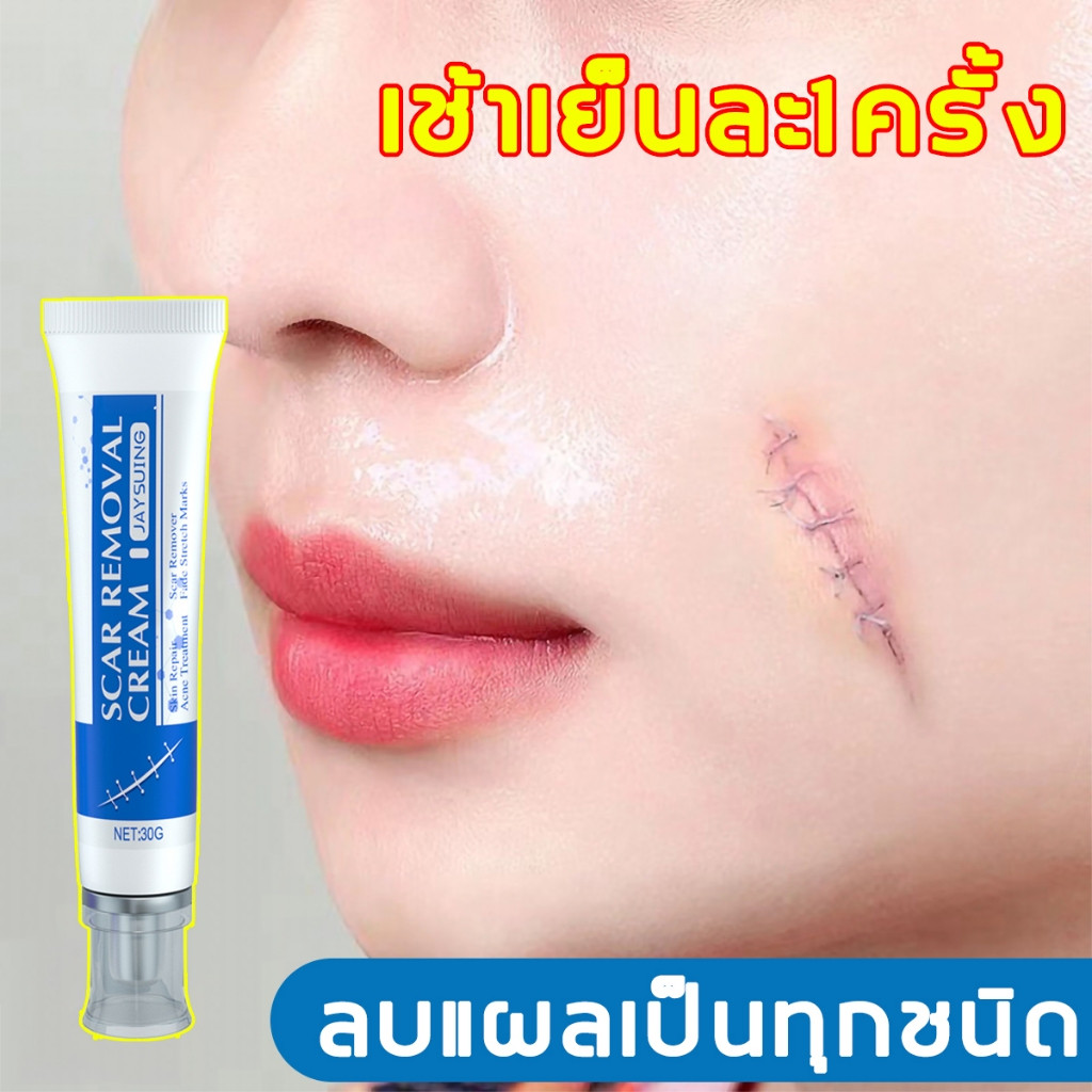 Scar reduction cream Scar removal cream Scar treatment cream Scar cream ...