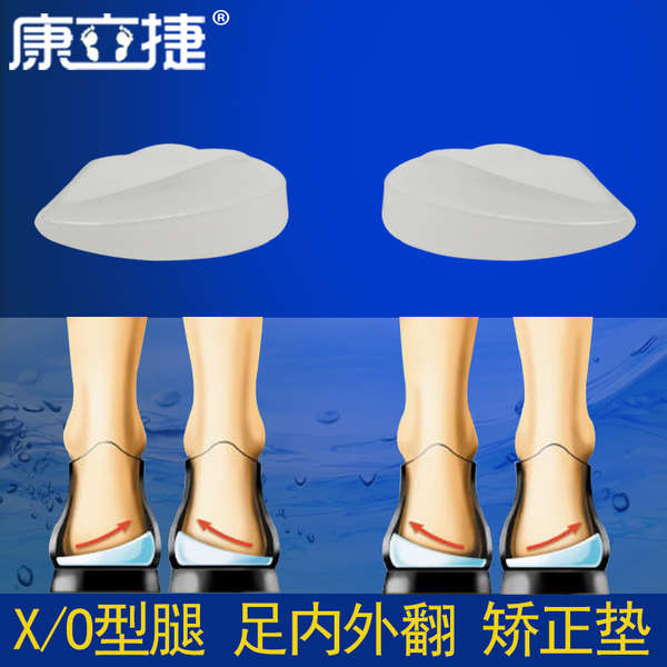 O-Type Leg Correction Leg Corrector o leg Insole pembetulan valgus kaki ...