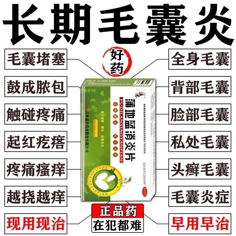 Daojun Pudi Blue Anti-Inflammatory Tablets g * Tablets Box Specializes ...