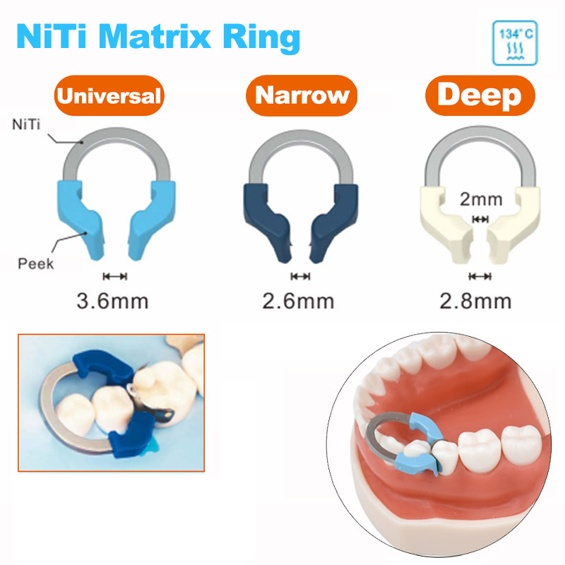 1Pcs Dental Matrix Bands NITI Metal Matrices Clamp Ring Sectional ...