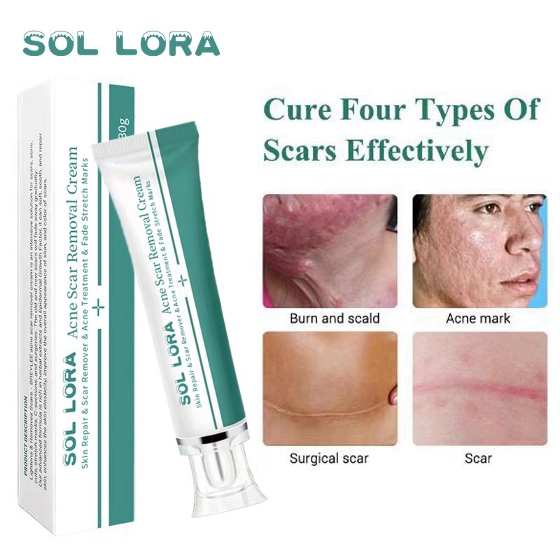 Store Recommended#现货SOL LORA Skin Repair Cream Reduce Scars 3ff | Shopee Malaysia