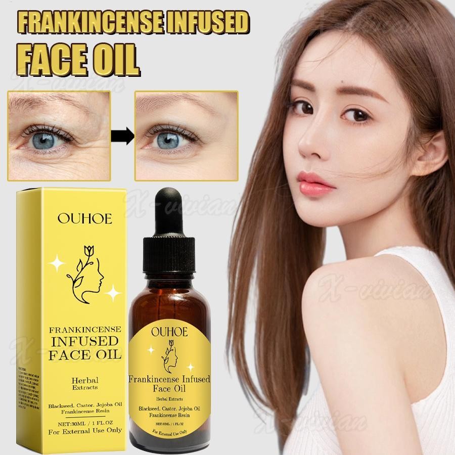 Frankincense Essential Oil Face Massage Oil Skin Moisturizer Natural Cold Pressed Frankincense ...