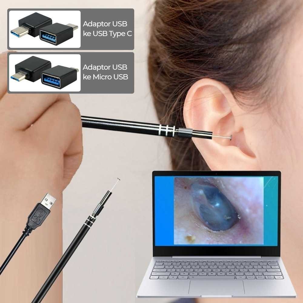 Taffomicron Ear Cleaning Endoscope Camera HD Endoscope USB - EU-0 ...