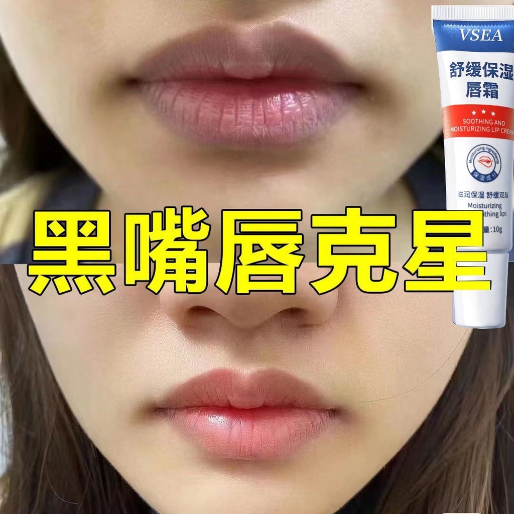 Removal Around Lips Black Lip Essence Care Lip Balm Fade Lip Lines ...