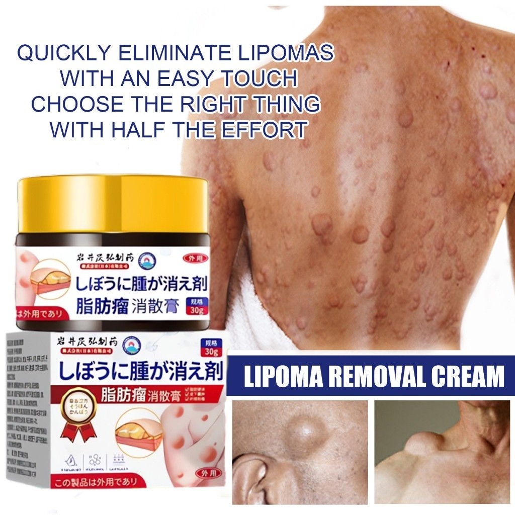 Original subcutaneous Lipoma 消除脂肪瘤 脂肪块 Lipoma Removal Cream Elimination ...